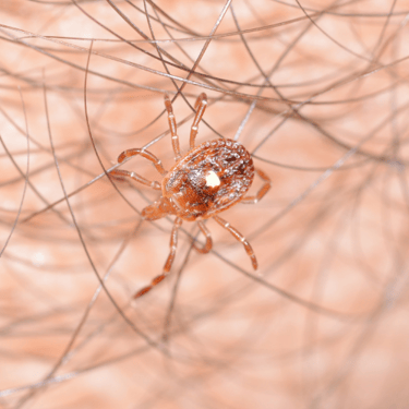 Seed Ticks: What they are and how to remove them